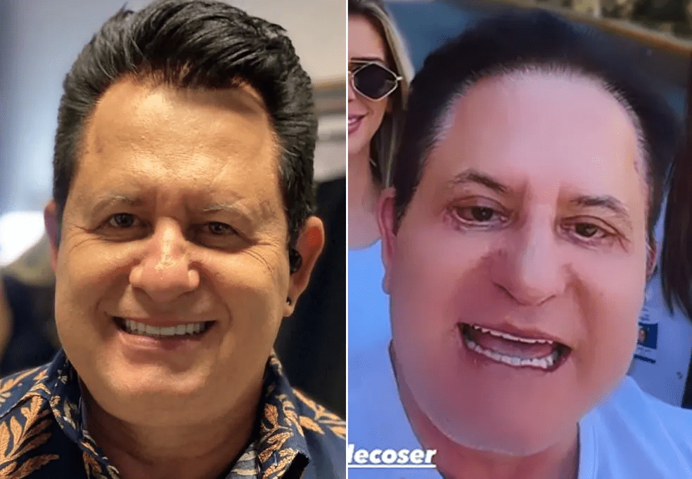 Stênio Garcia não foi o único: veja harmonização facial de famosos que ... Stênio Garcia não foi o único: veja harmonização facial de famosos que ...
